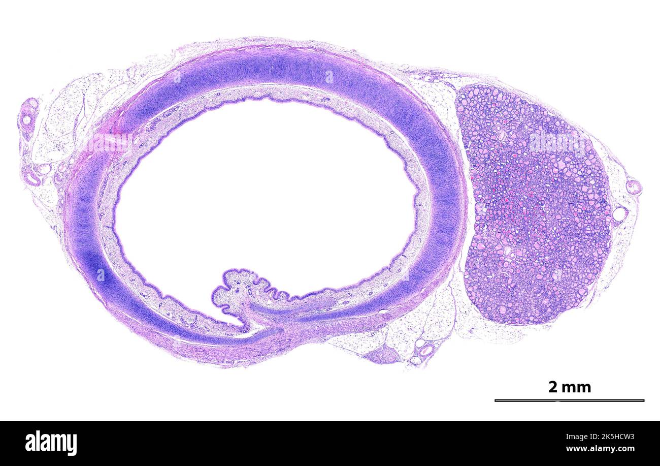 Low power light microscope micrograph of a cross section of the trachea ...