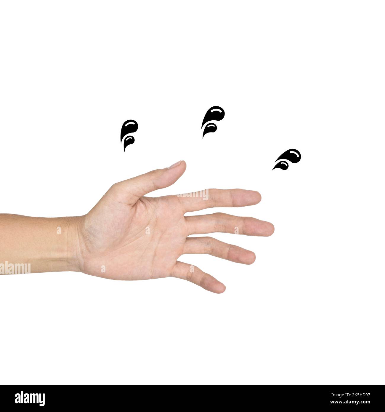 Palmar aspect of sweaty and oily hand. Left sided sweating palm ...