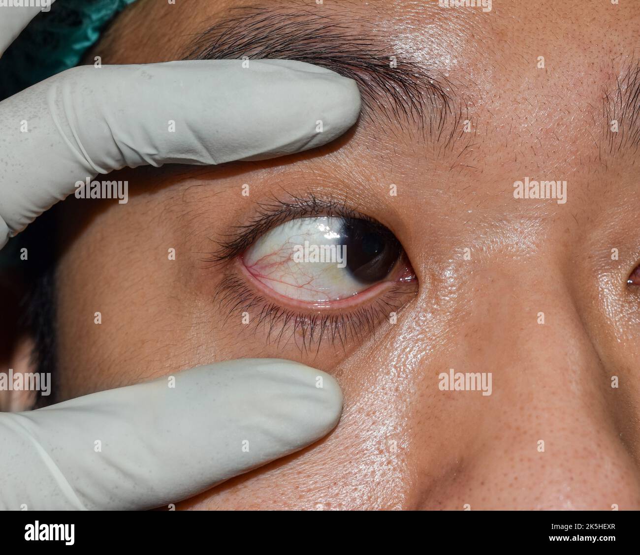 Black eye lid hi-res stock photography and images - Alamy