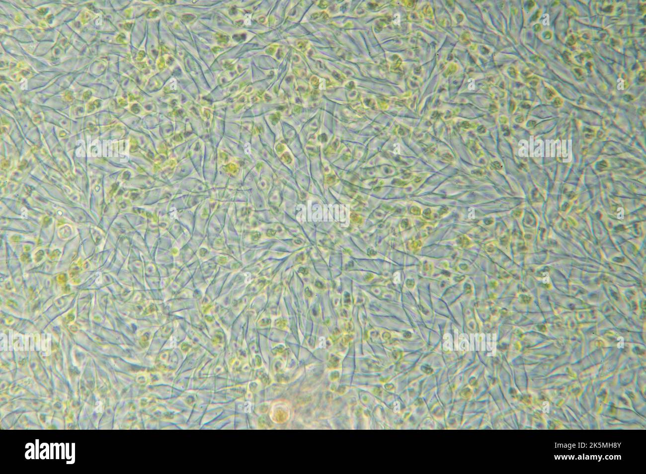 Microscope image of algae from freshwater pond, Wales, UK Stock Photo ...