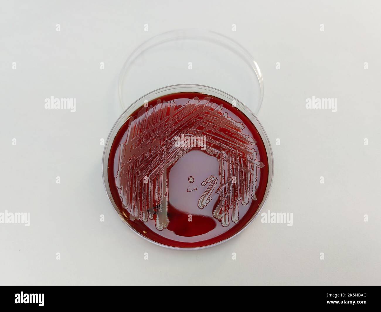 A Staphylococcus aureus bacteria displayed on blood agar plate on a ...