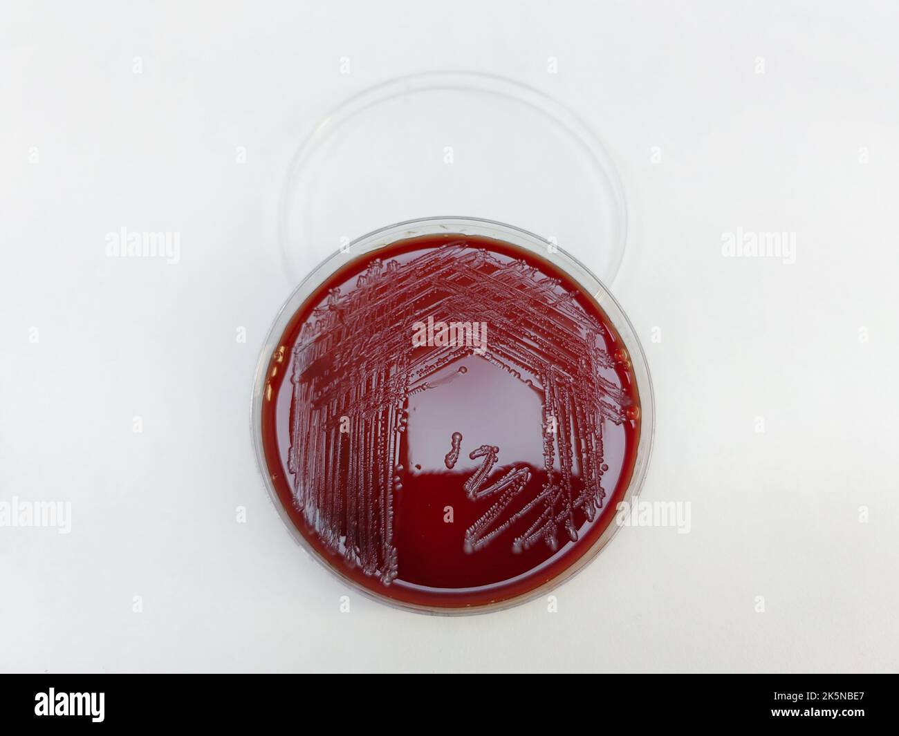 A Staphylococcus aureus bacteria displayed on a blood agar plate on ...
