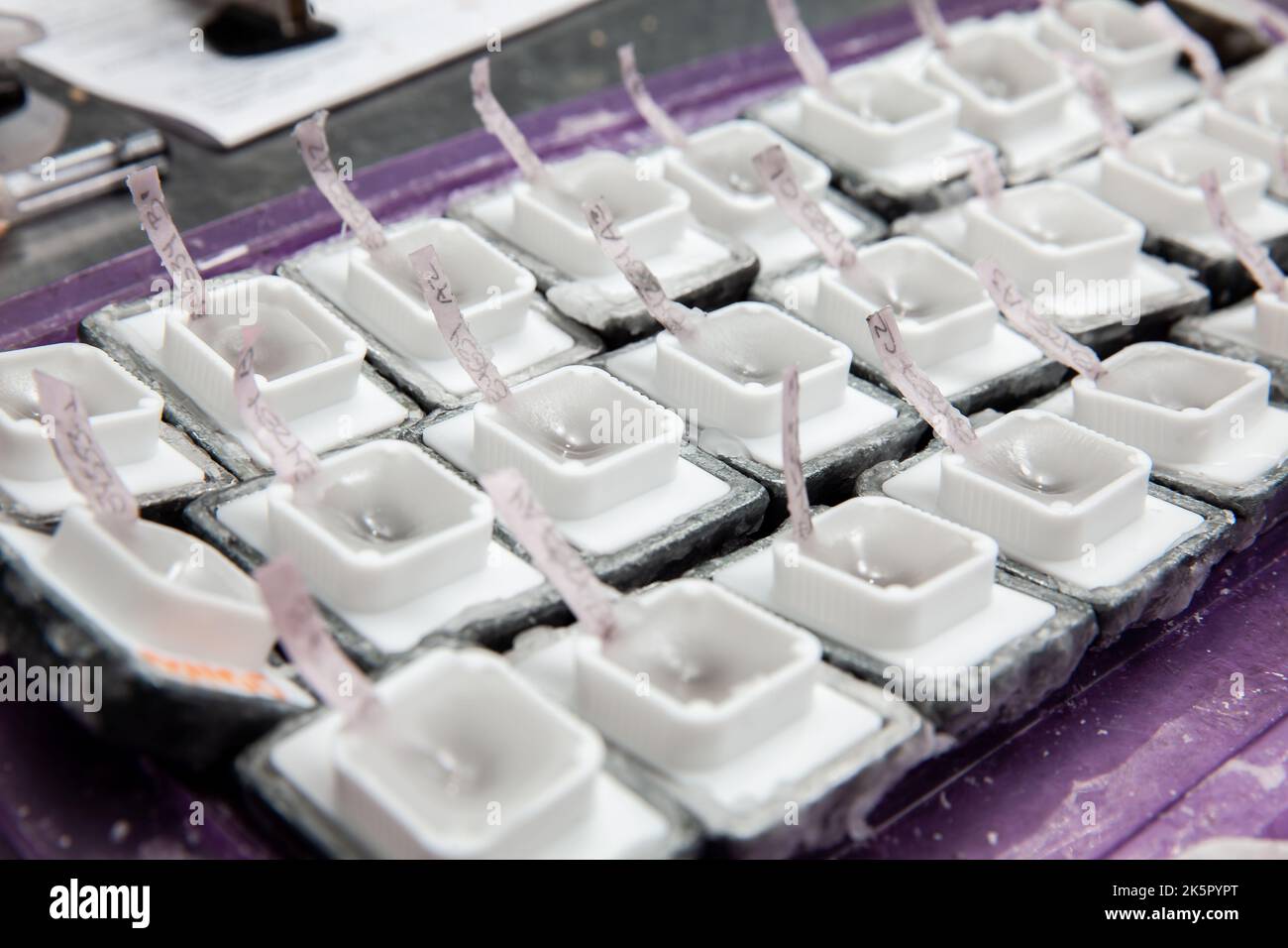 Embedded tissues in paraffin blocks for sectioning. Pathology ...