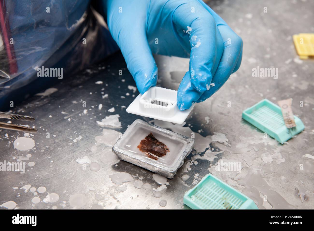 Scientist Embedding Tissues In Paraffin Blocks For Sectioning