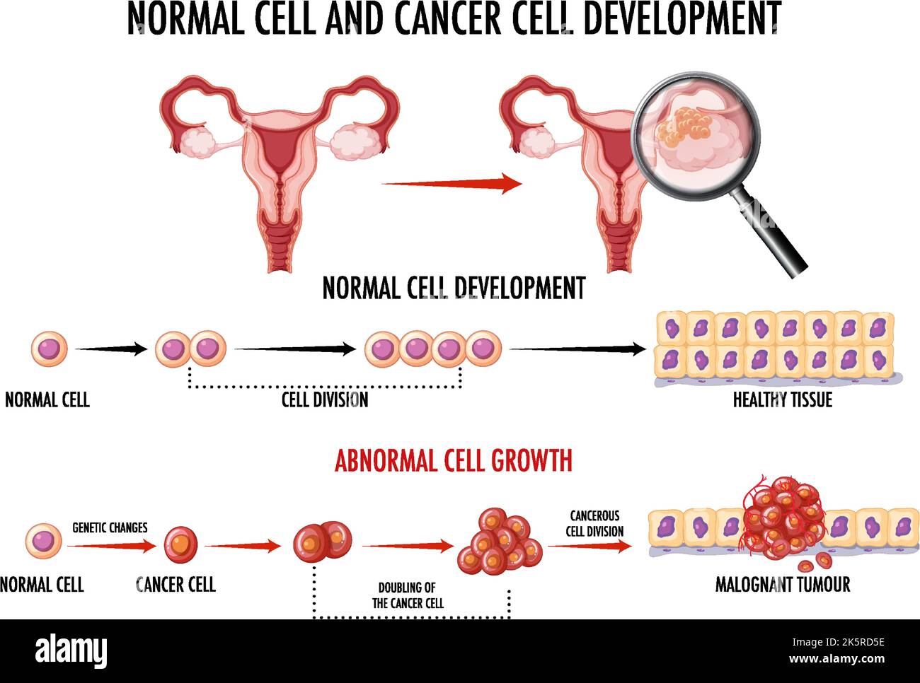 Diagram showing normal and cancer cells illustration Stock Vector Image ...