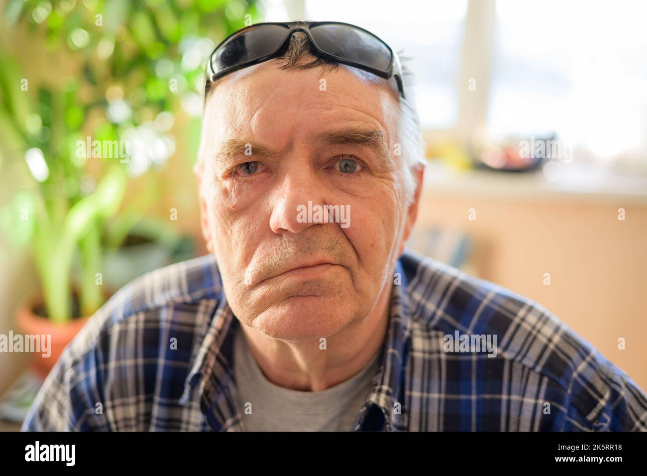 Aged man with facial nerve paralysis, Bell's palsy Stock Photo - Alamy
