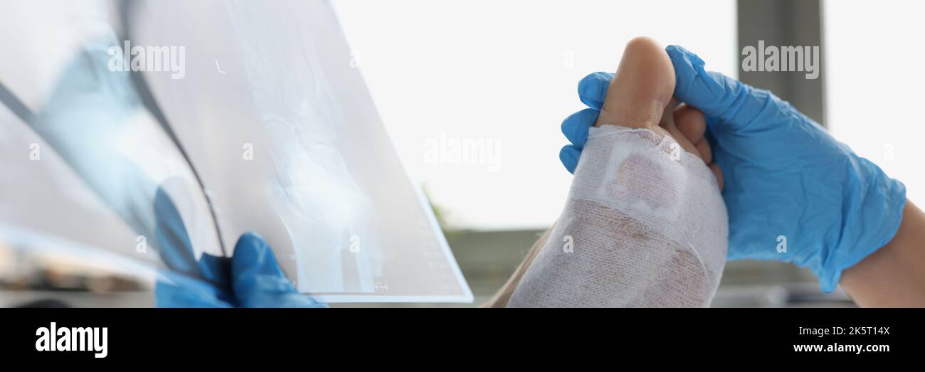 Doctor medical examination with leg injury and x-ray Stock Photo - Alamy