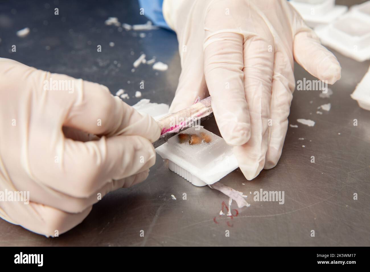 Scientist preparing paraffin blocks containing biopsy tissue for ...