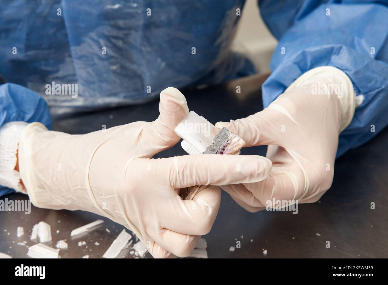 Scientist Preparing Paraffin Blocks Containing Biopsy Tissue For Sectioning Pathology