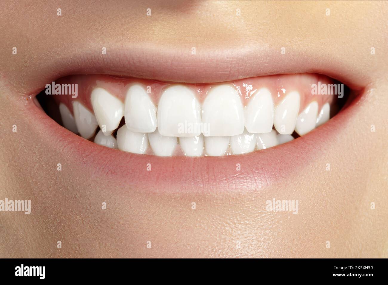 Dental Beauty. Beautiful Macro with perfect White Teeth. Natural Make-up. Whitening Tooth ...