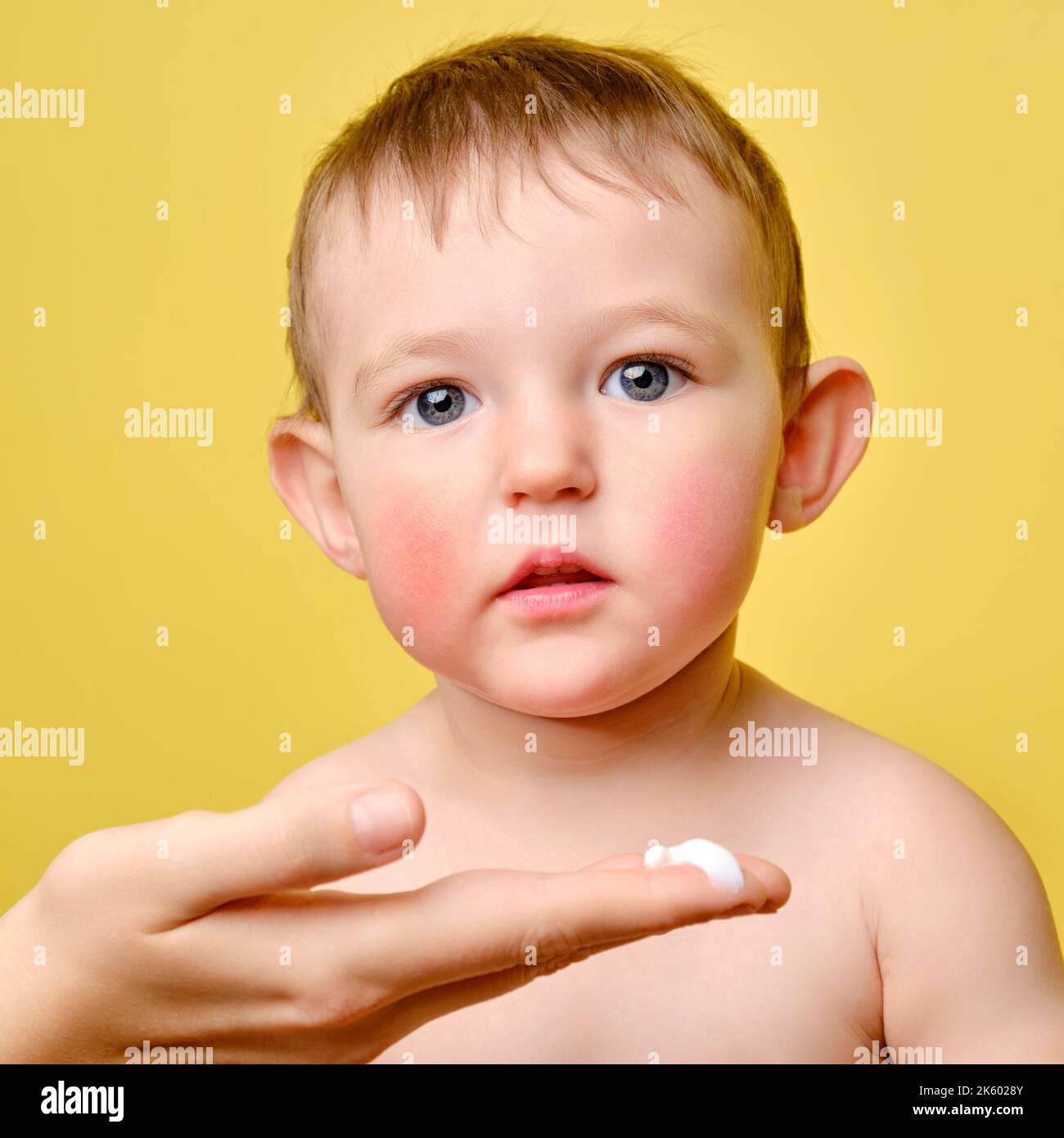 Mother smears allergy cream on face of toddler baby, studio yellow ...