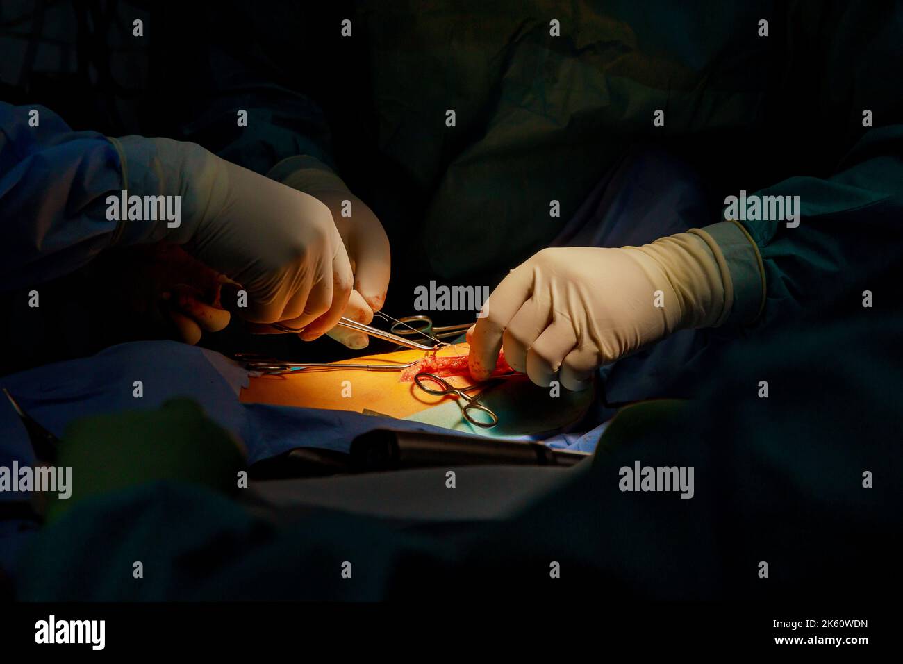 An operating room doctor sews up the wound leg of an injured patient ...