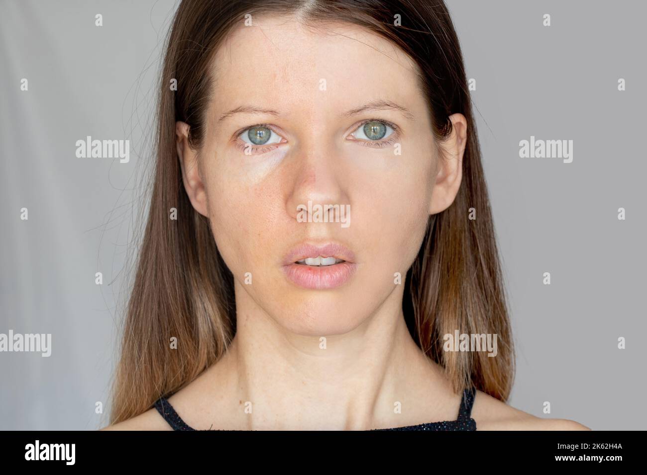 Before after comparison model hi-res stock photography and images - Alamy