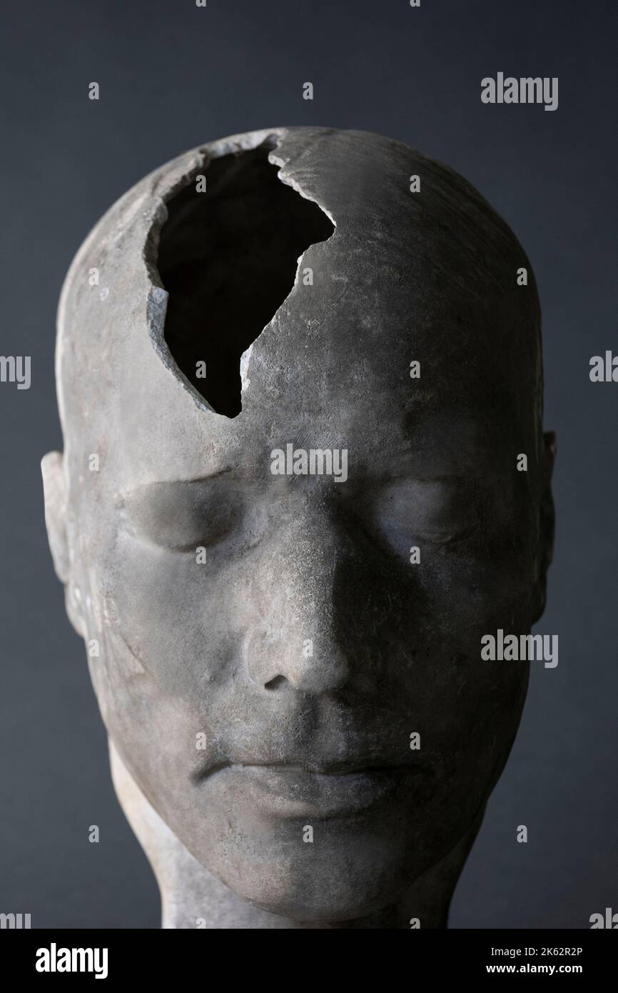 Mental Health Concept Showing Model Of Head With Fractured Piece In ...