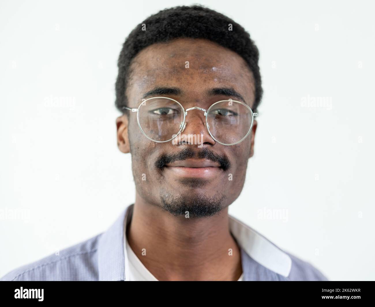 skincare treatment smart man acne problem smiling Stock Photo - Alamy