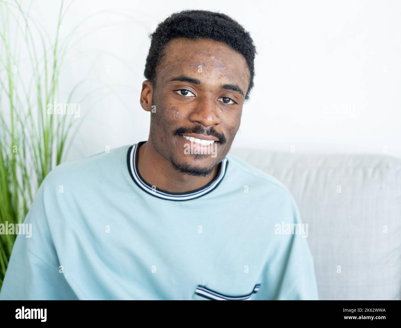 dermatology problem happy man acne hygiene Stock Photo - Alamy