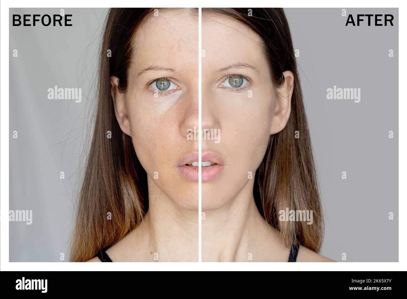 The face of a young girl is divided into two halves with and without ...