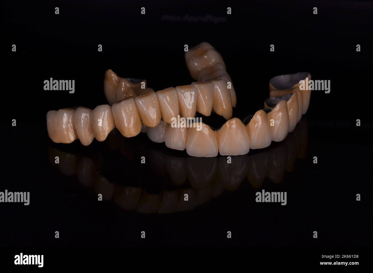Metal ceramic tooth crowns hi-res stock photography and images - Alamy