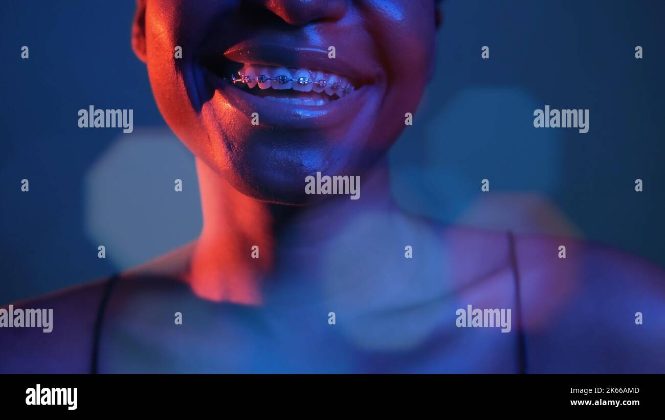 happy smile orthodontic care mouth teeth braces Stock Photo - Alamy