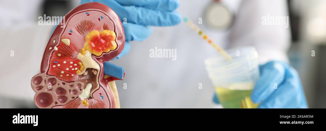 Artificial model of kidney and ureter of human standing on table of ...