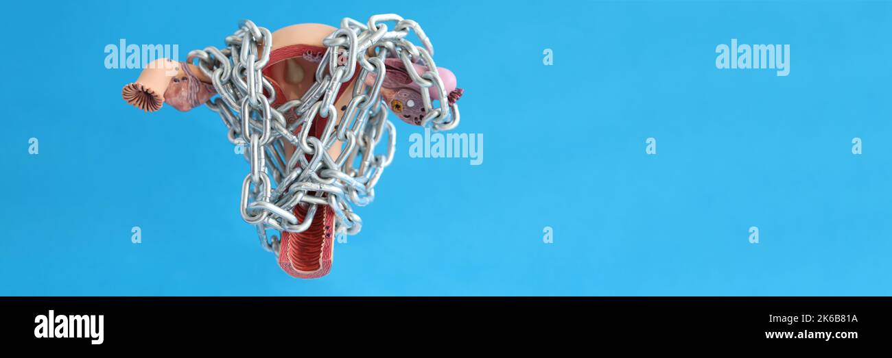 Medical concept of uterine and abdominal pain with pain chain Stock ...