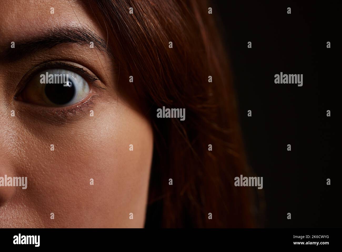 Dont call me baby. a young woman experiencing mental illness against a ...