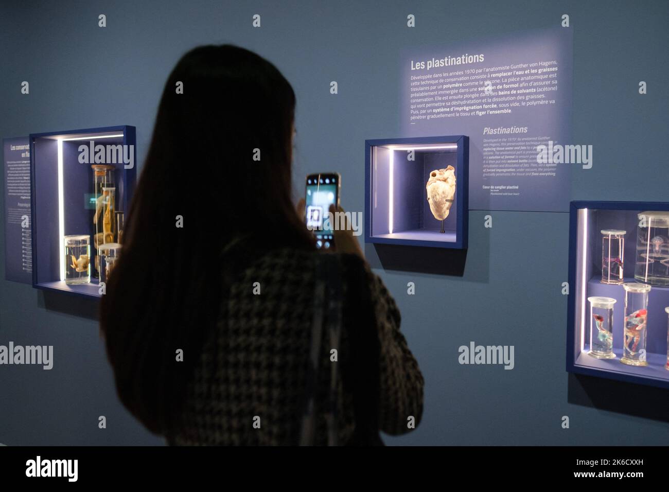 Visitor taking a picture of a boar's heart, preserved by the ...