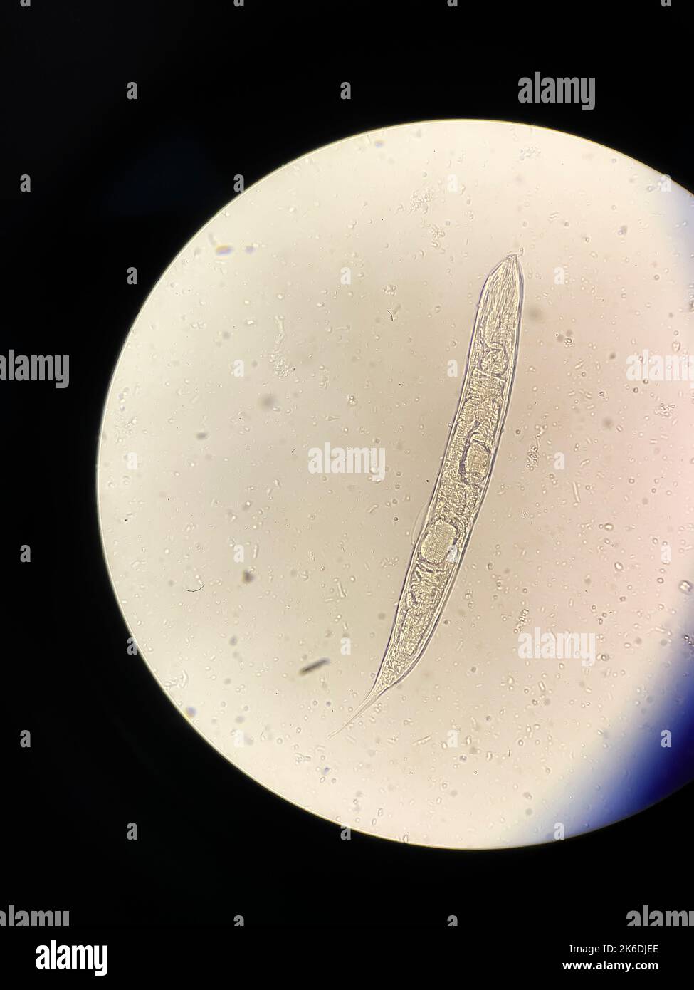 A vertical shot of a parasite Stock Photo - Alamy