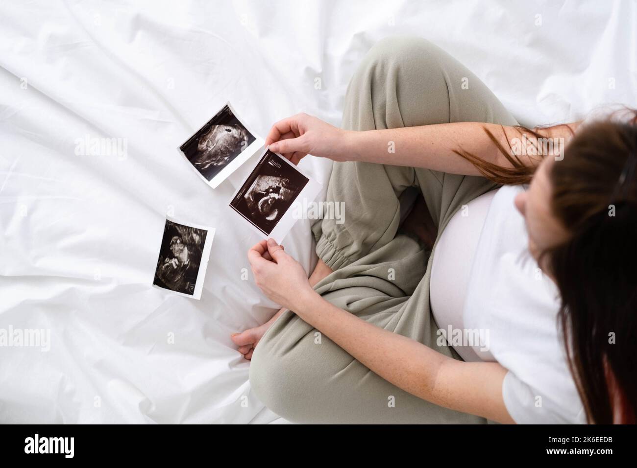 Top view cropped of pregnant woman looking ultrasound photo of fetus ...