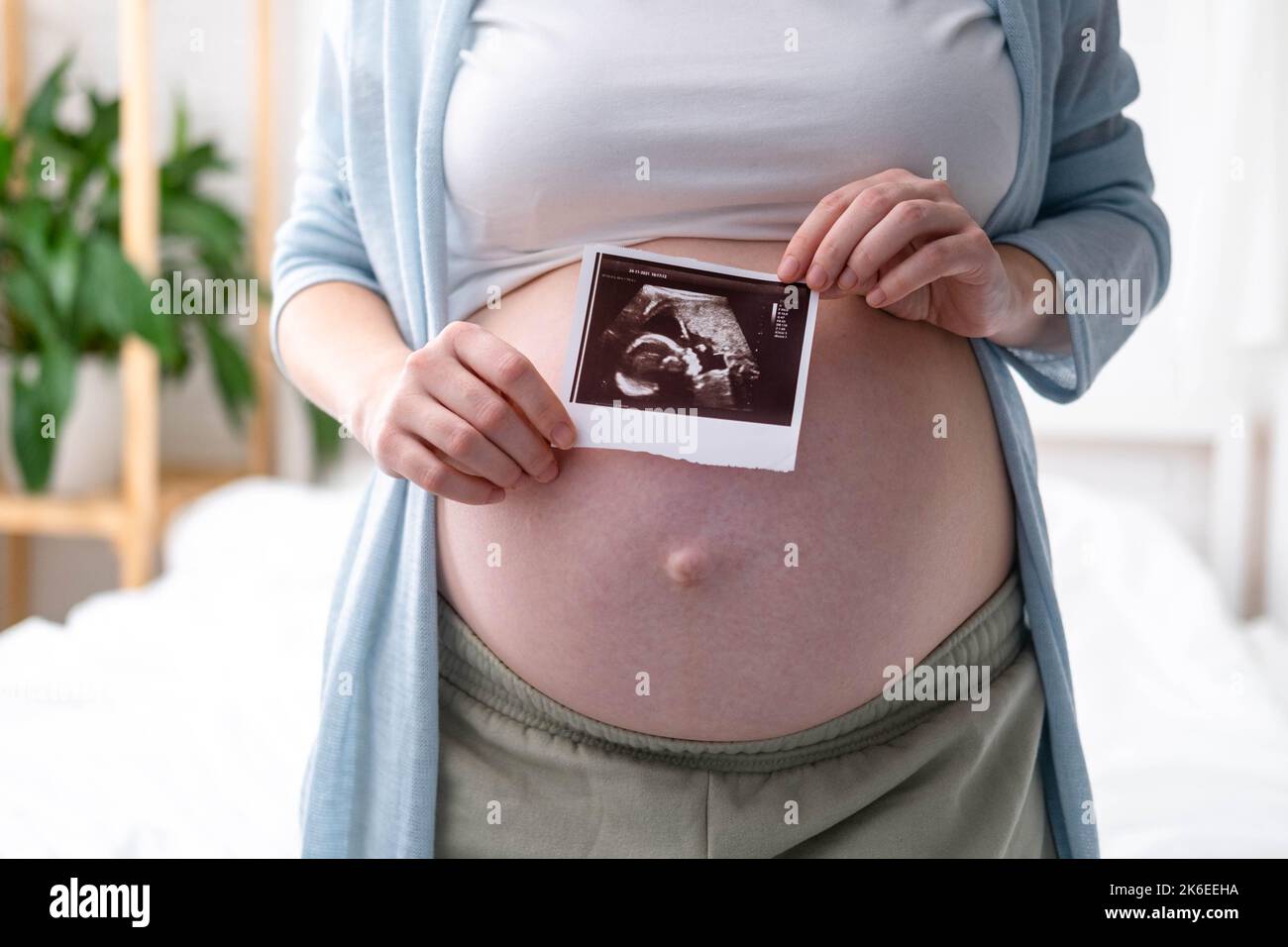 Top view cropped of pregnant woman with ultrasound photo of fetus ...