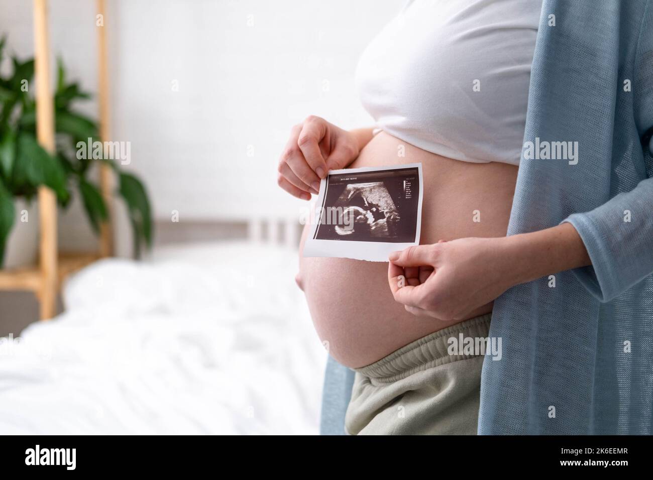 Top view cropped of pregnant woman with ultrasound photo of fetus ...