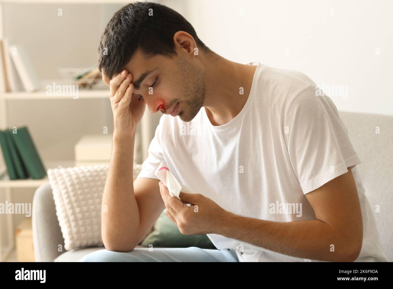 Young man holding tissue with nasal blood at home Stock Photo - Alamy