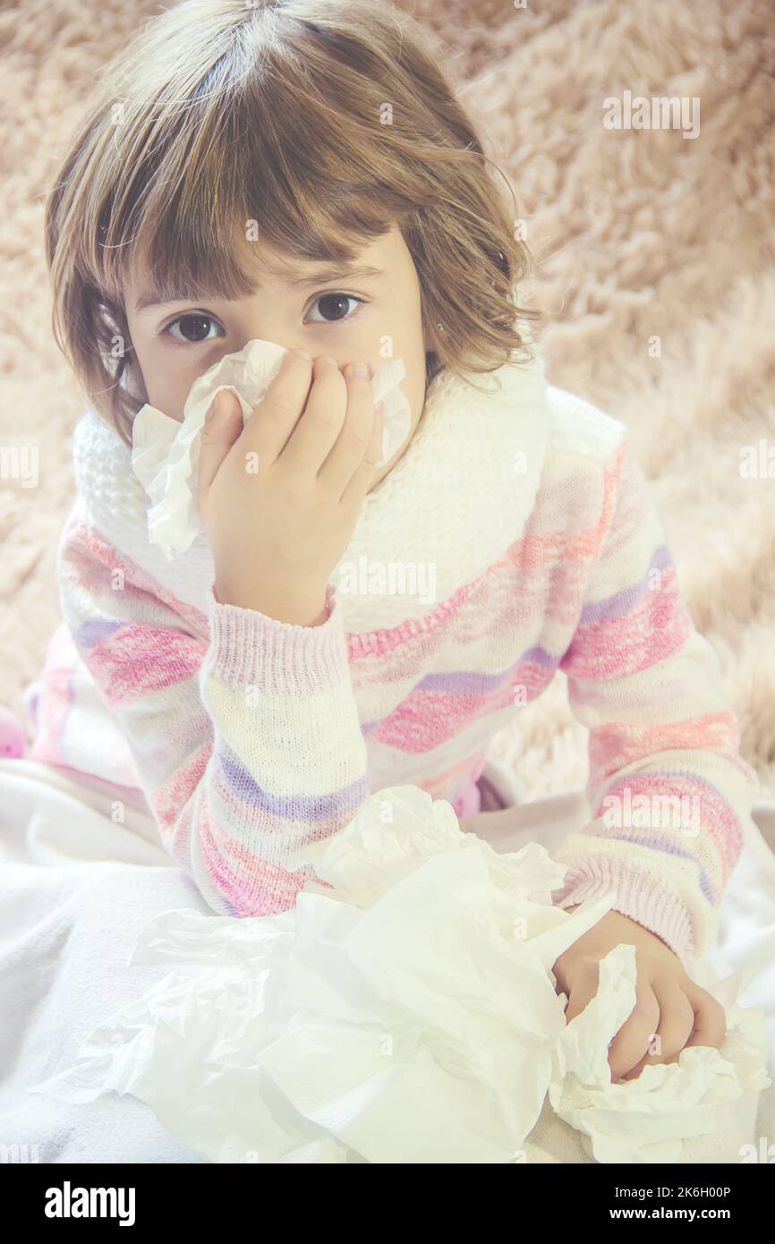 Inflammation snuffle hi-res stock photography and images - Alamy