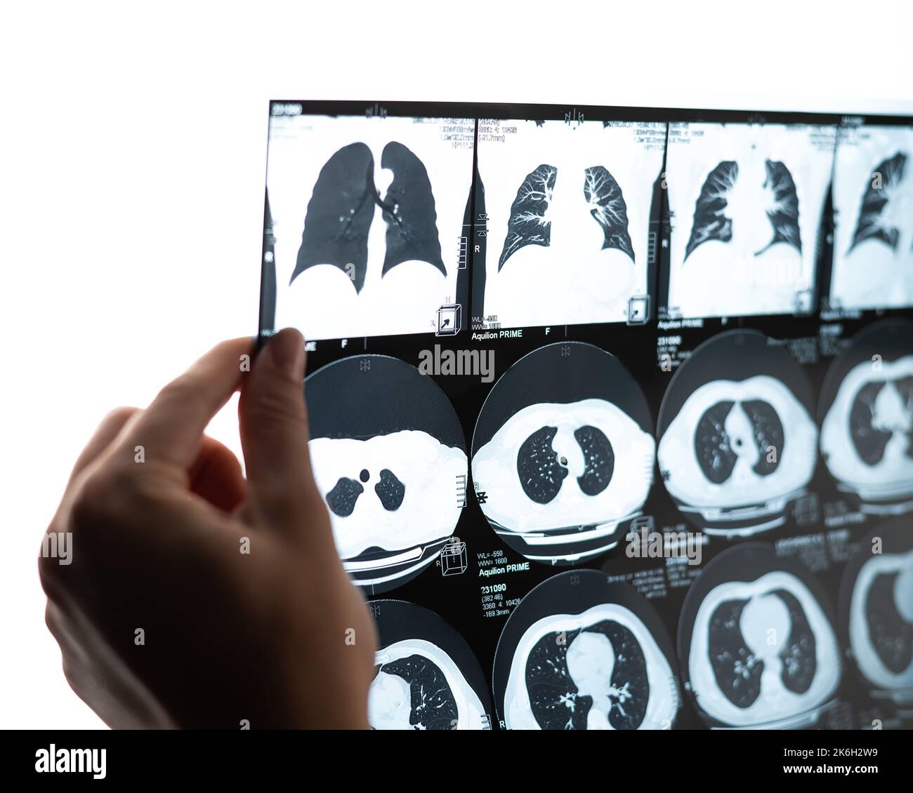 A female doctor examines an MRI scan of the internal organs. Abdomen ...