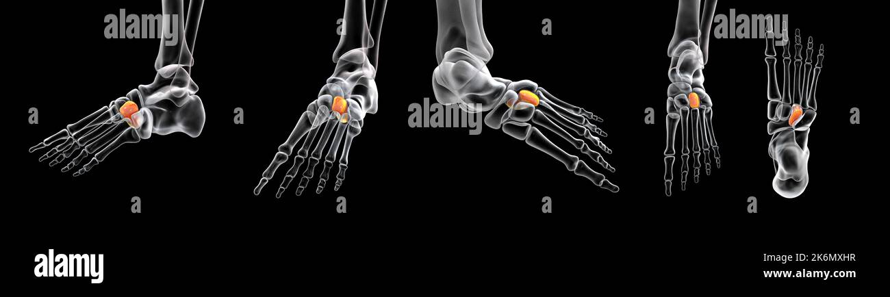 Lateral cuneiform bone, illustration Stock Photo - Alamy