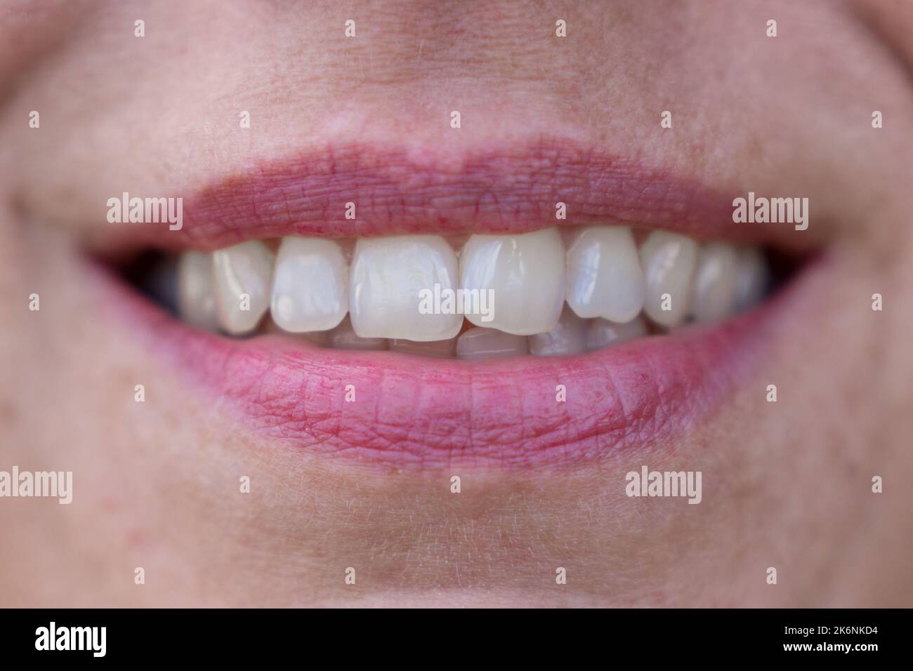 Shiny teeth hi-res stock photography and images - Alamy
