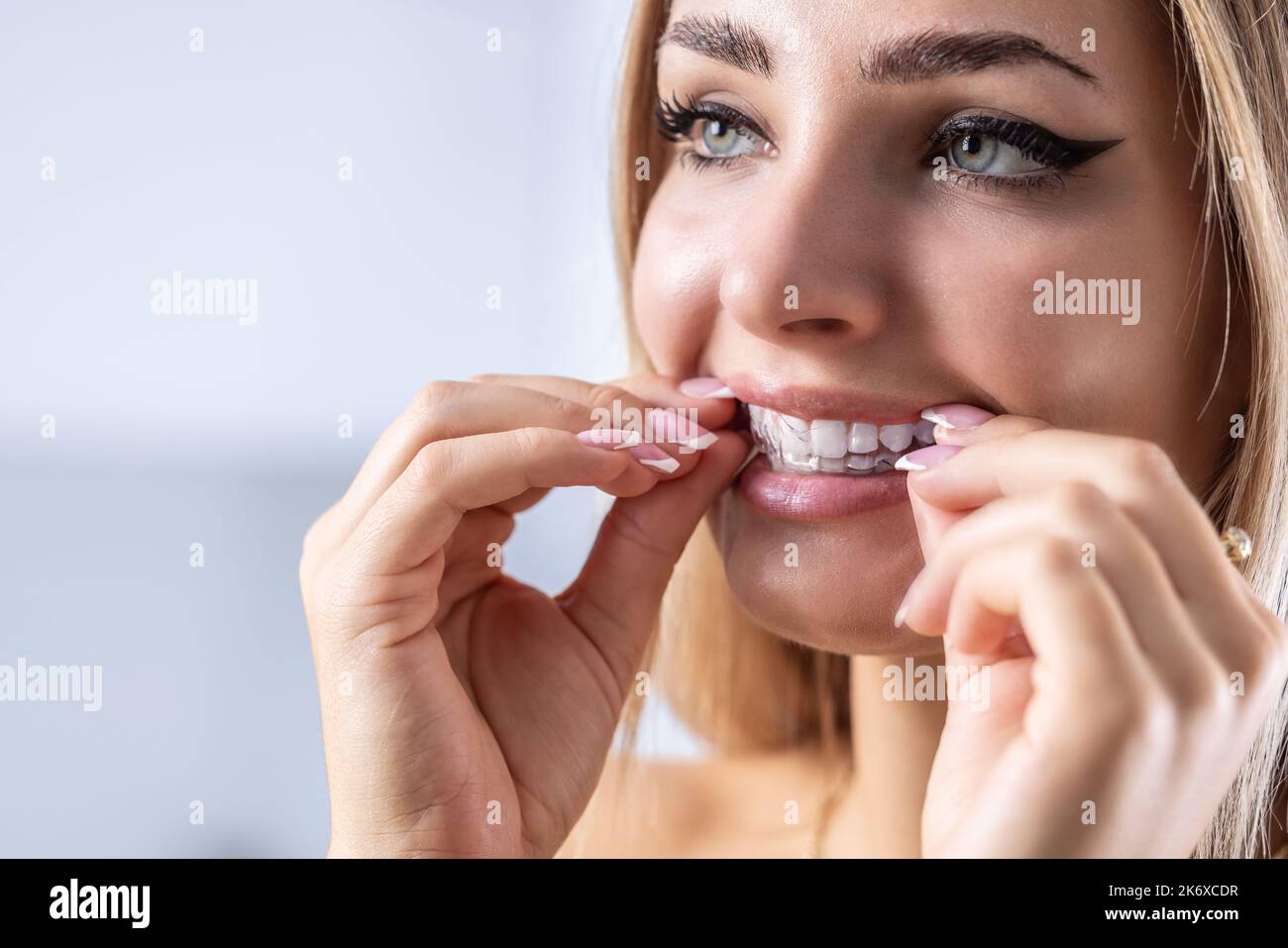 A woman puts on an invisible silicone teeth aligner. Dental braces for ...