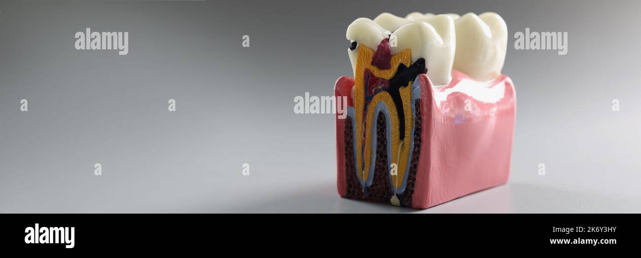 Tooth Cross Section Labeled