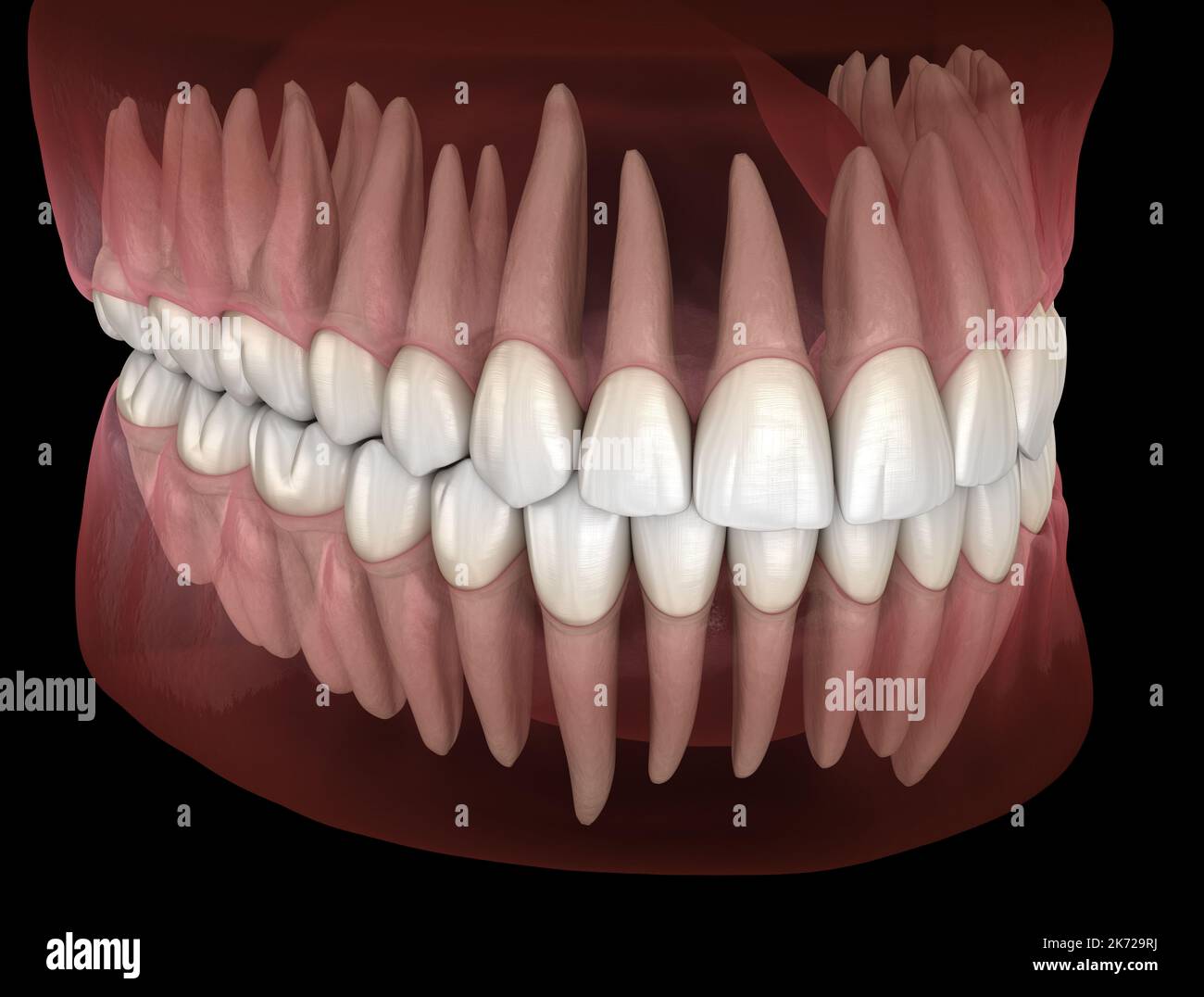 Morphology of human teeth. Medically accurate tooth 3D illustration ...