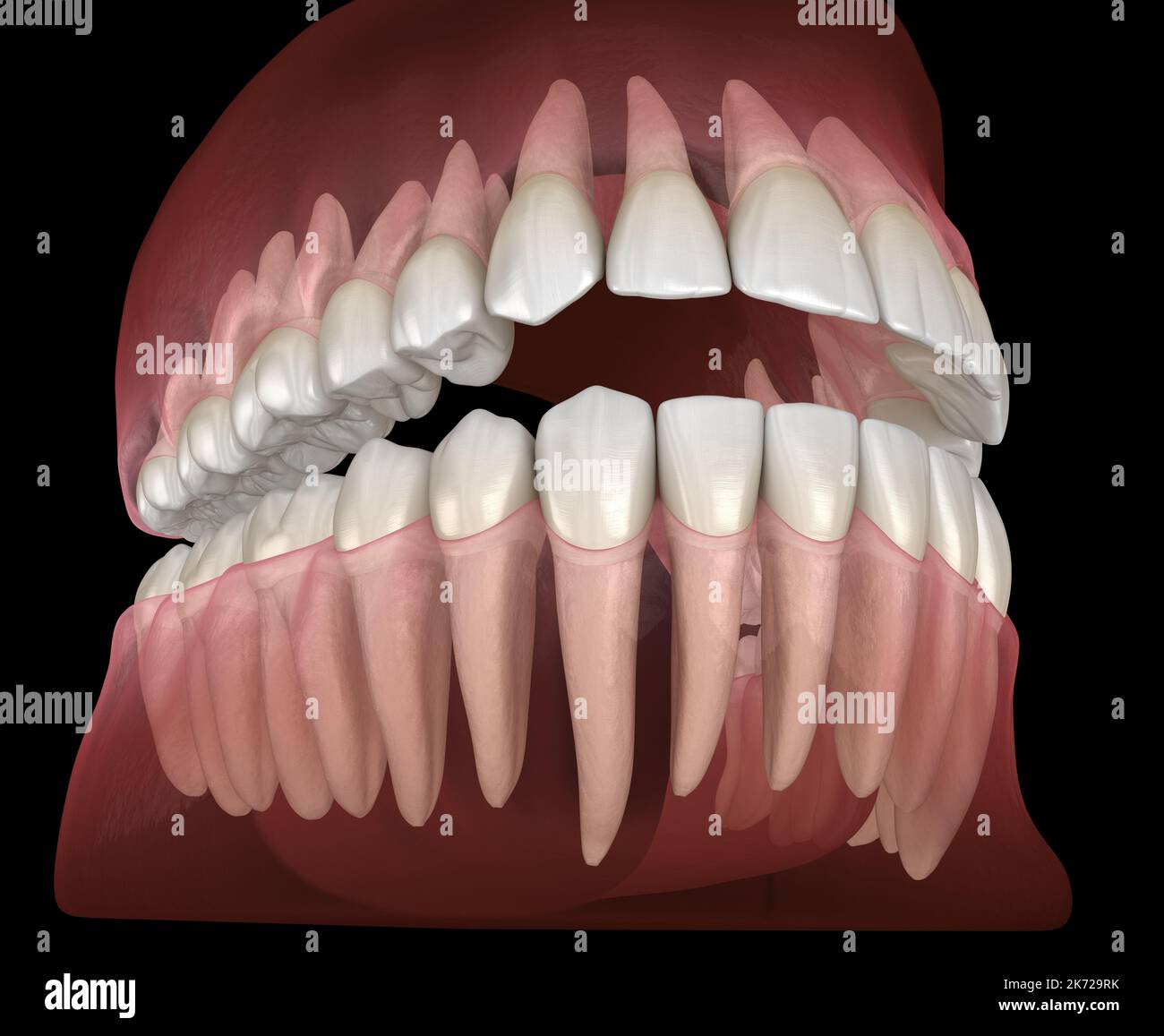 Morphology of human teeth. Medically accurate tooth 3D illustration ...