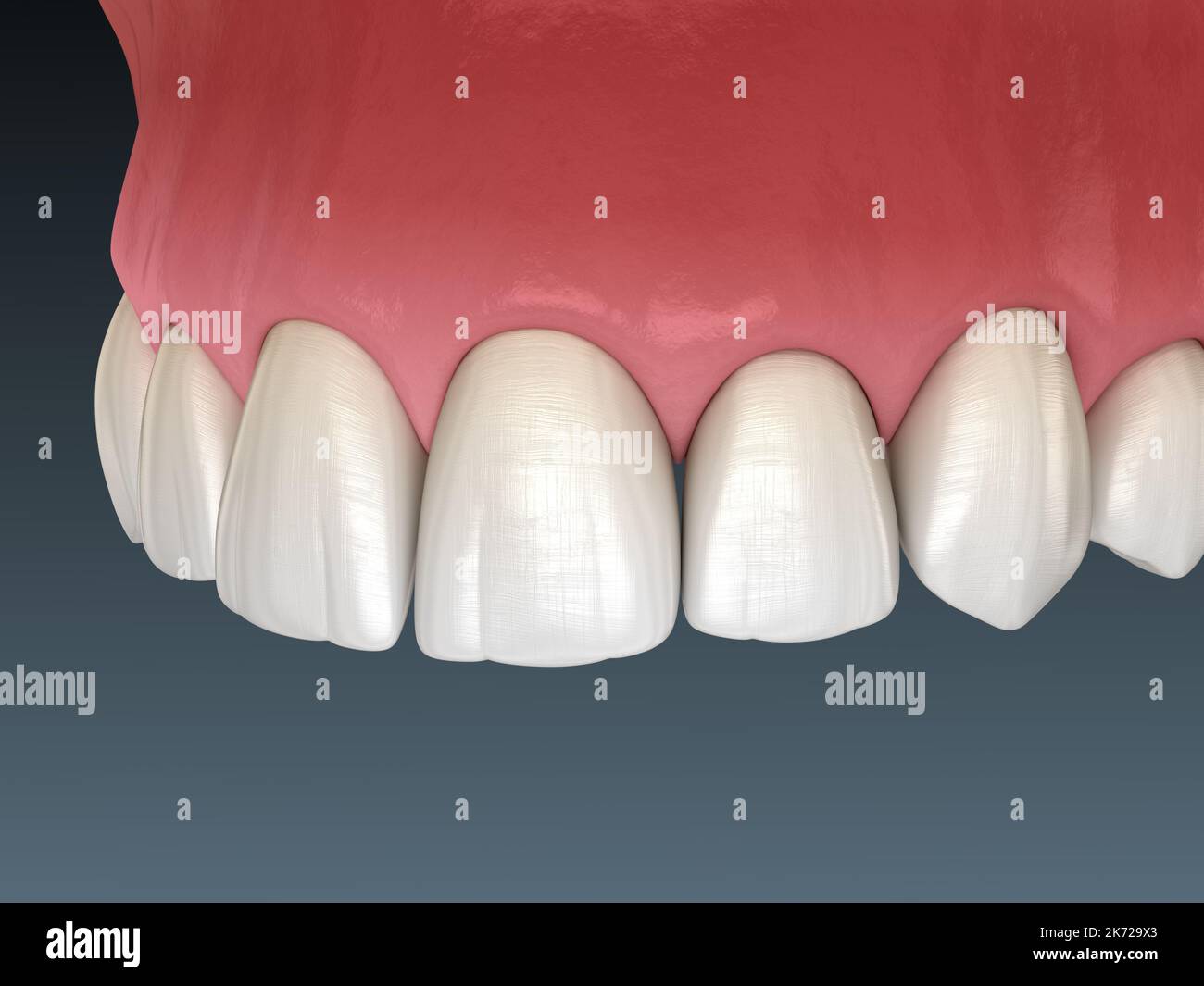 Maxillary human gum and teeth. Medically accurate tooth 3D illustration ...