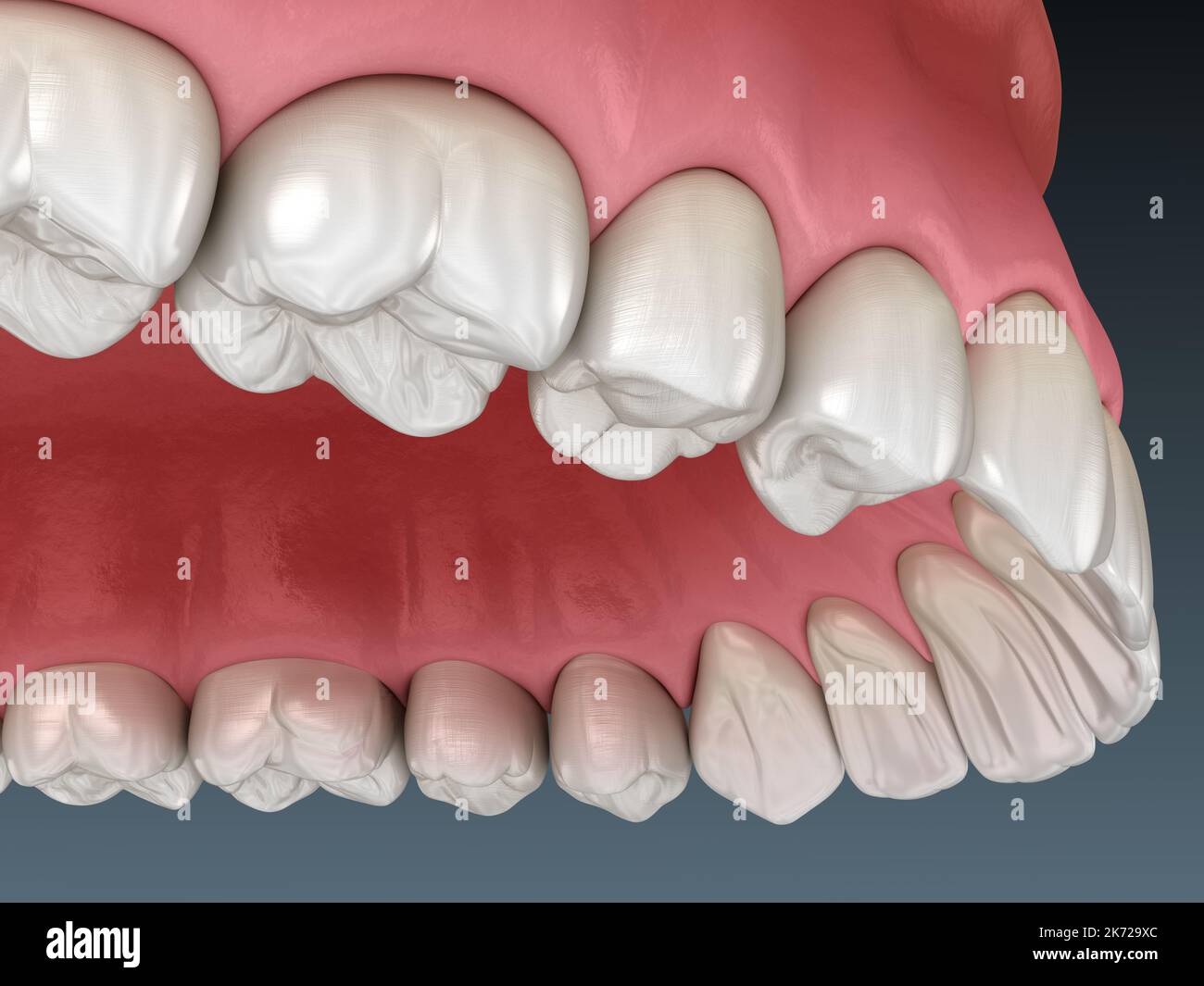 Maxillary human gum and teeth. Medically accurate tooth 3D illustration ...