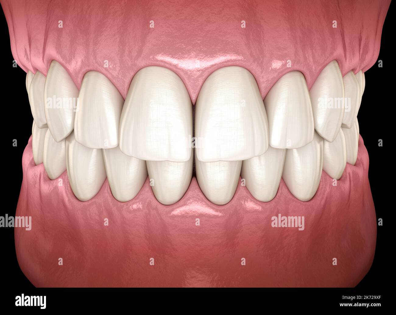 Healthy human teeth with normal occlusion. Medically accurate tooth 3D ...