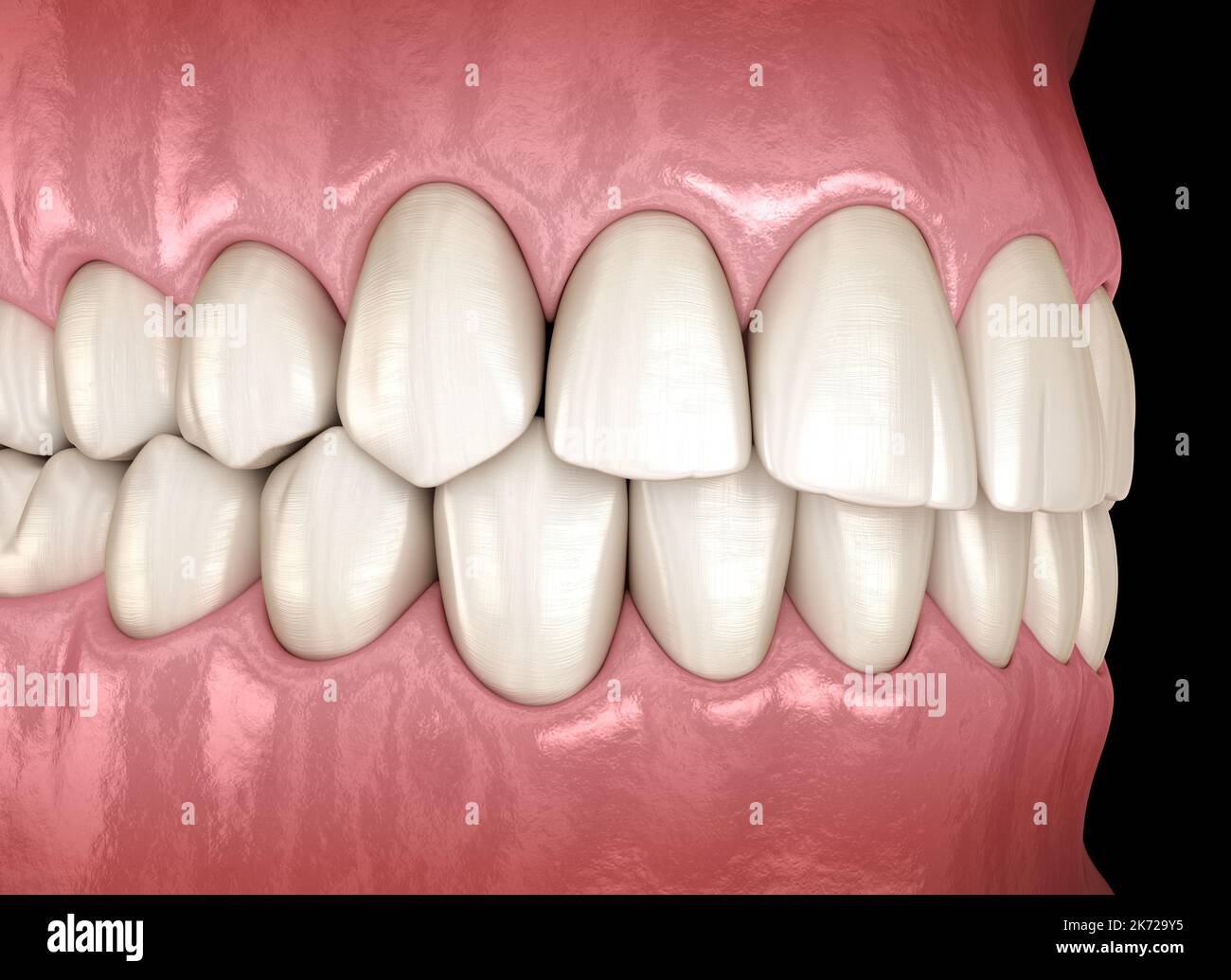 Healthy human teeth with normal occlusion. Medically accurate tooth 3D ...
