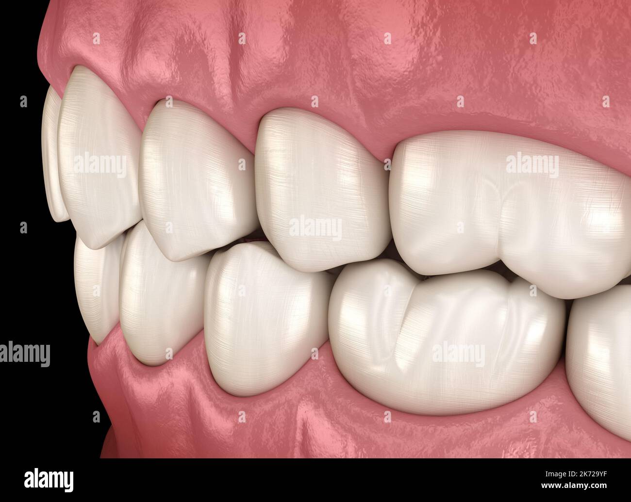 Healthy human teeth with normal occlusion. Medically accurate tooth 3D ...