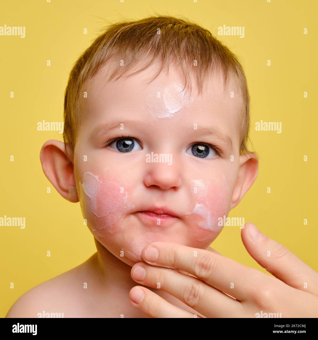 Red cheeks ill child hi-res stock photography and images - Alamy