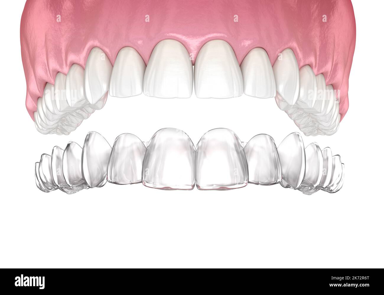 Invisalign braces or invisible retainer. Medically accurate dental 3D ...