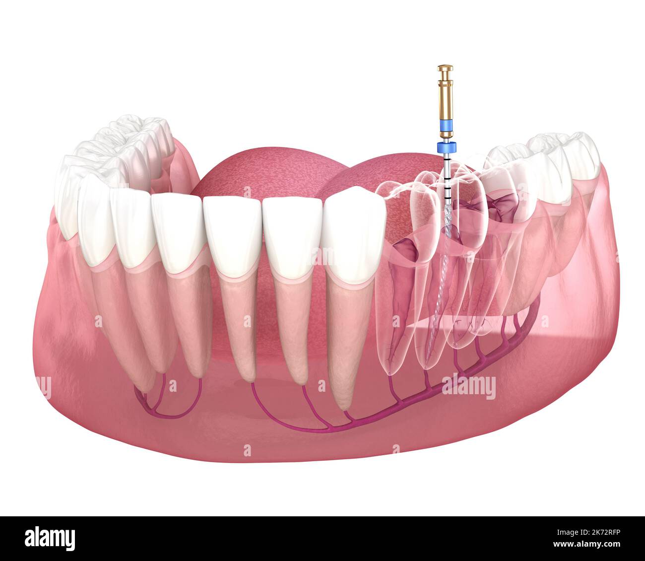 Endodontics Root Canal Location at Dorothy Ledford blog