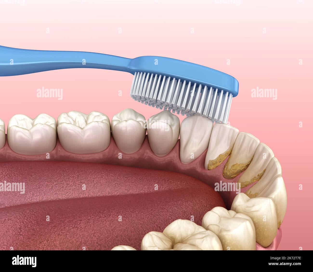 Toothbrush cleaning teeth. Medically accurate 3D illustration of oral ...