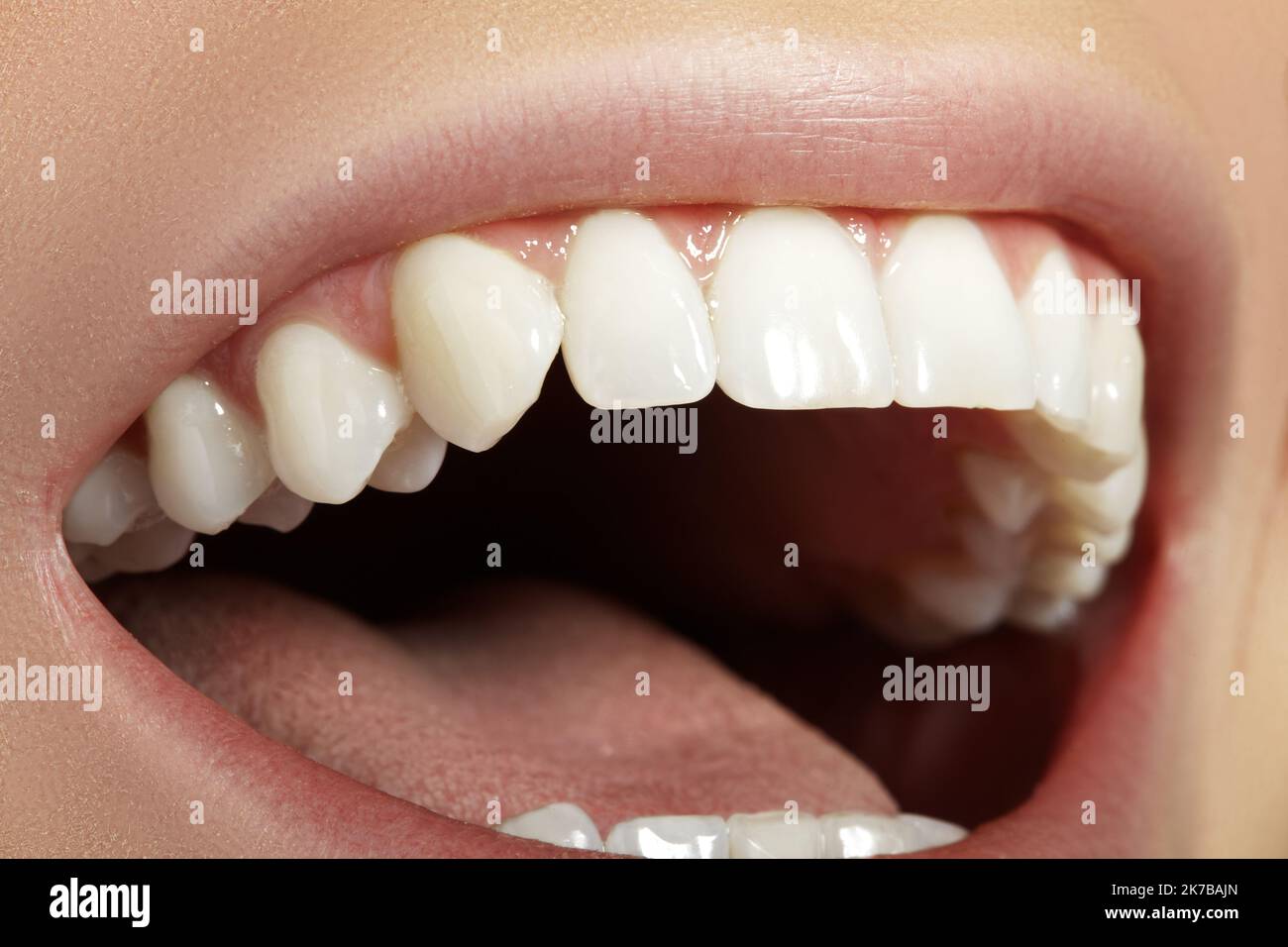 Dental Beauty. Beautiful Macro with perfect White Teeth. Fashion Lips ...